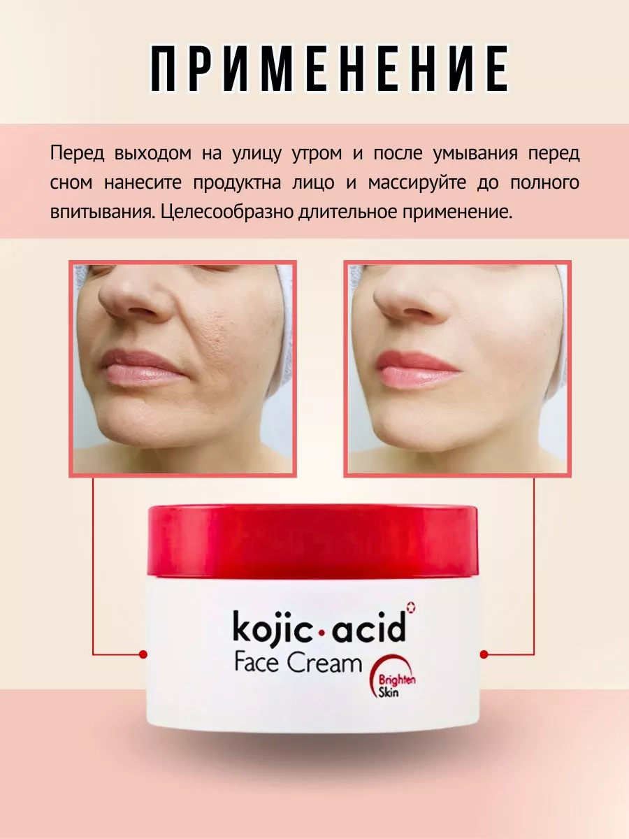 Kojic acid cream store